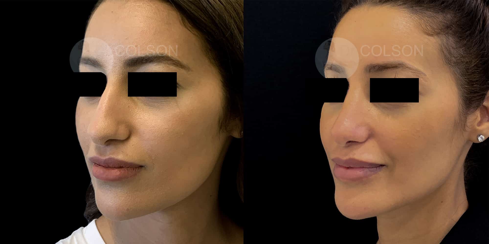 Visage – Docteur COLSON Thomas – Chirurgie Plastique, Reconstructrice ...